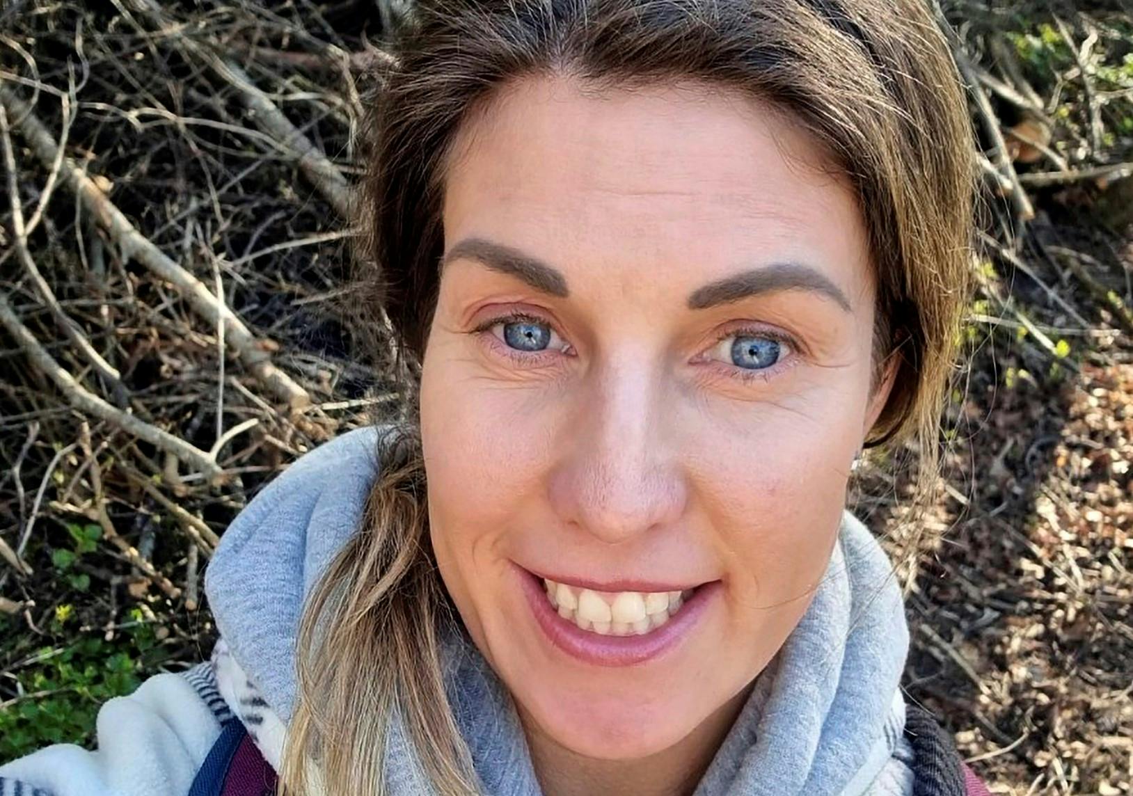 Efter et liv med eksem: Stine fik et nyt ansigt | Ude og Hjemme